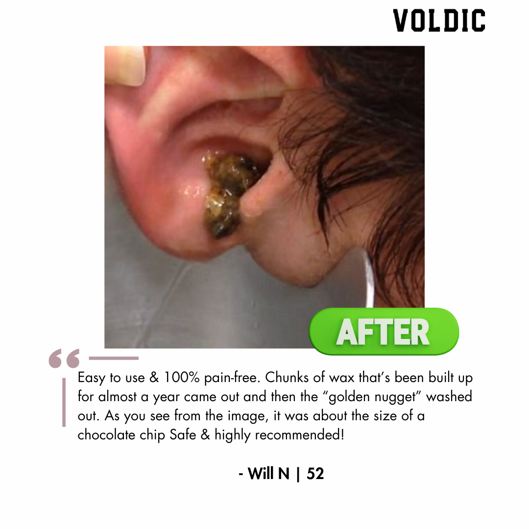Voldic Ear Wax Removal Kit Advertorial