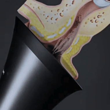 Top 5 Ear Wax Removal Kits – Voldic